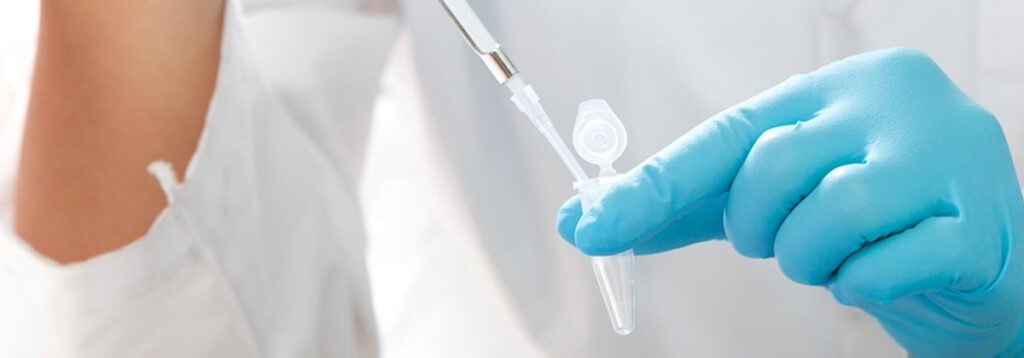 ERA Test - Novafertil IVF Center